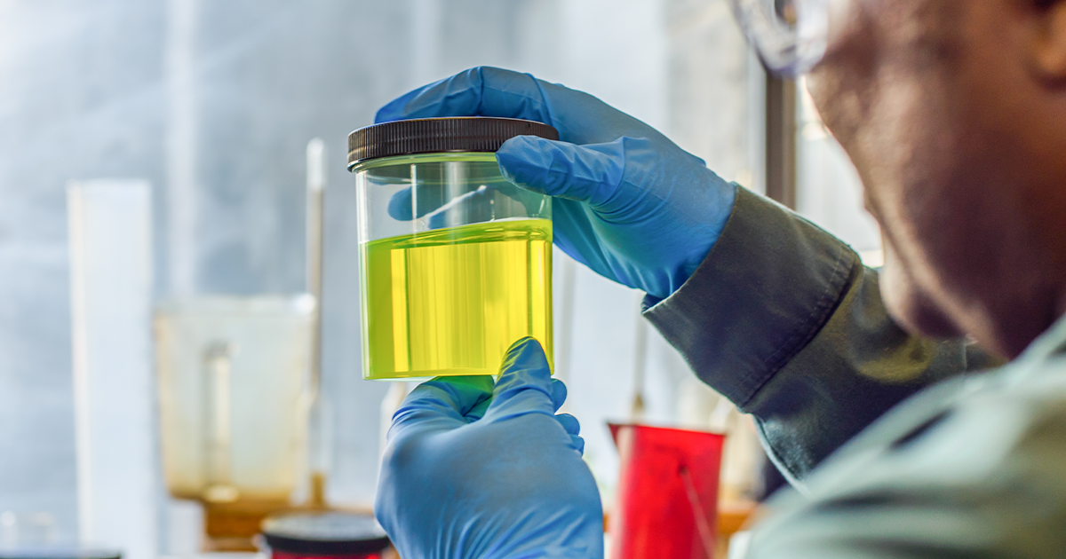 Biocombustibles: Avances y Desafíos | by Petro Punto | Medium