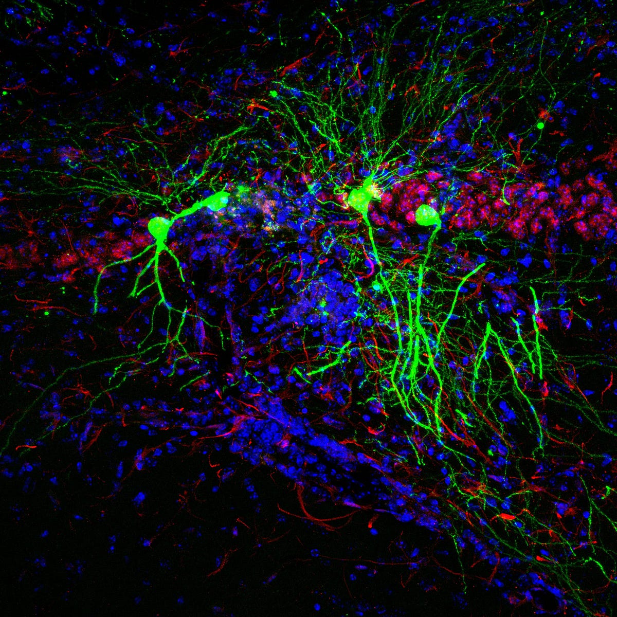 Uncovering the secrets of a brain parasite | by eLife | Health and ...