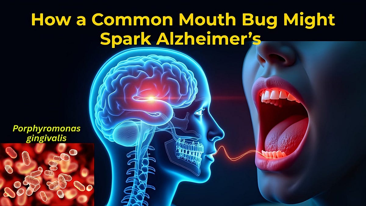 How a Common Mouth Bug Might Spark Alzheimer’s Disease | by Harshi ...