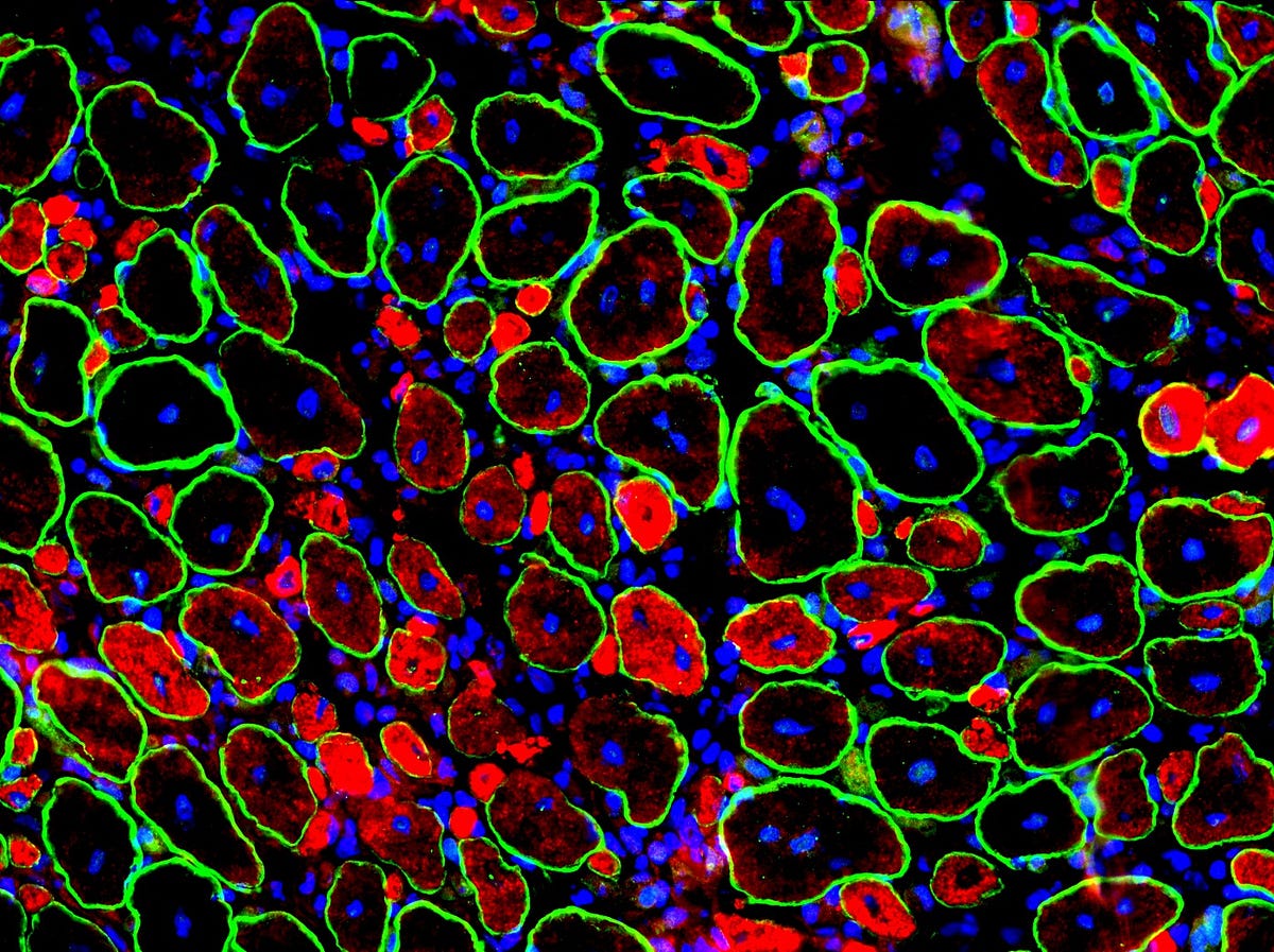 Self-destructing stem cells. Deleting the gene for Polo-Like Kinase ...