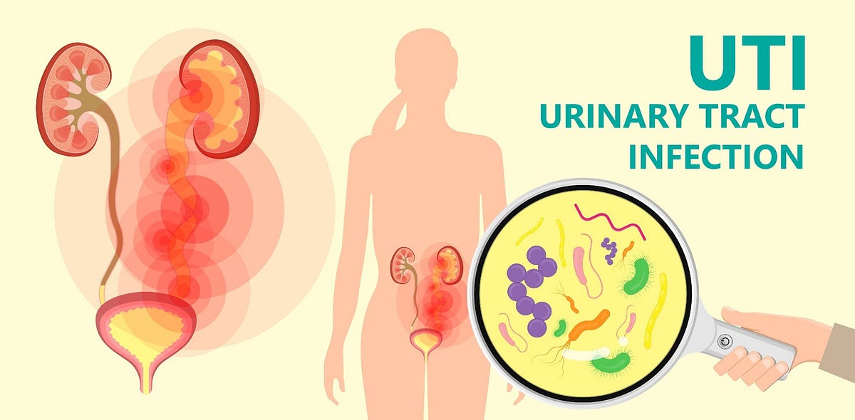 Urinary Tract Infections (UTIs). Navigating the Risks and Remedies of ...