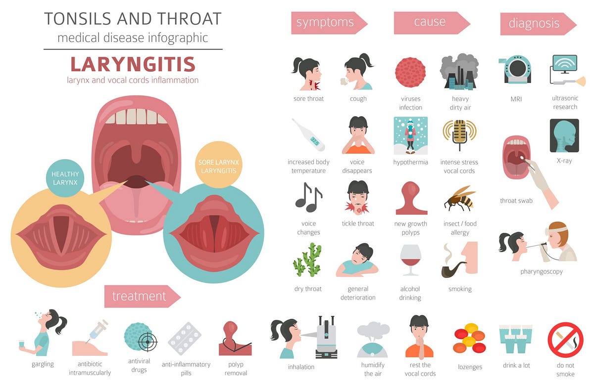 Strep Throat Understanding What It Is And How It Can Be Treated By Ashi Medium