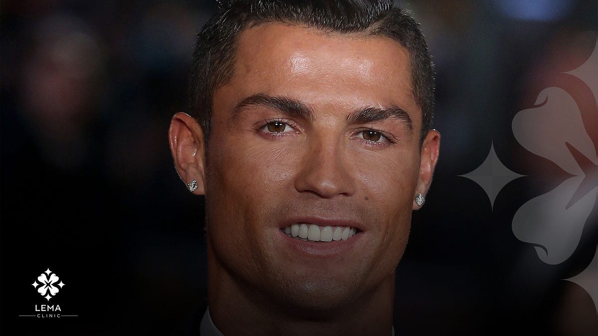 Il Trucco Del Sorriso Di Cristiano Ronaldo | by Uyesbek | Aug, 2024 | Medium