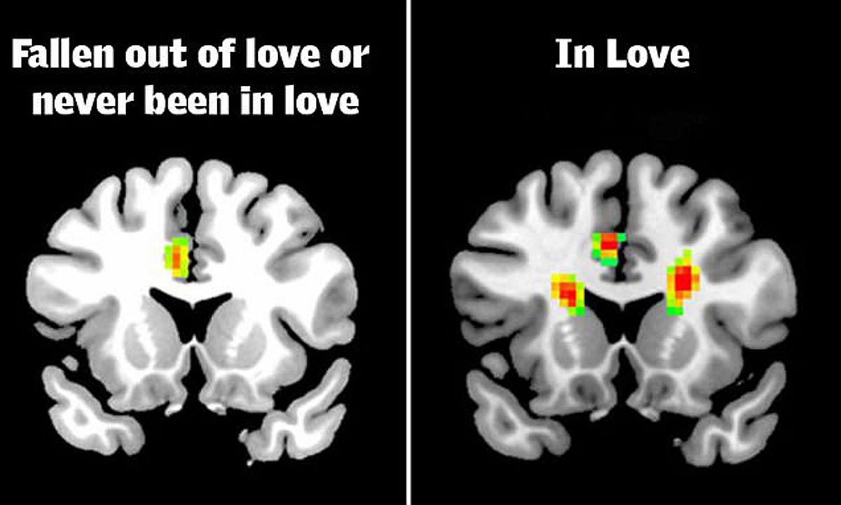 Our Brains Look Different When We’re in Love | by Wesley Owens | Love ...