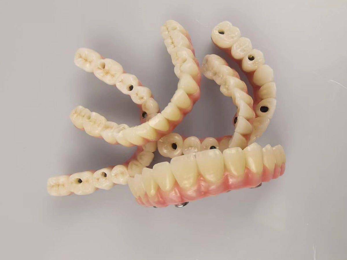 Revolutionizing Dentistry with Precision Implant Solutions | Medium
