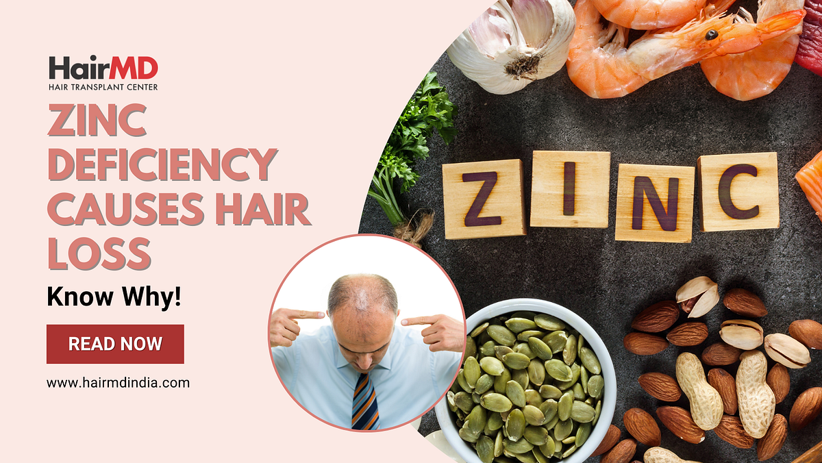 Zinc Deficiency Causes Hair Loss. Know Why! | by HairMD India | Aug ...