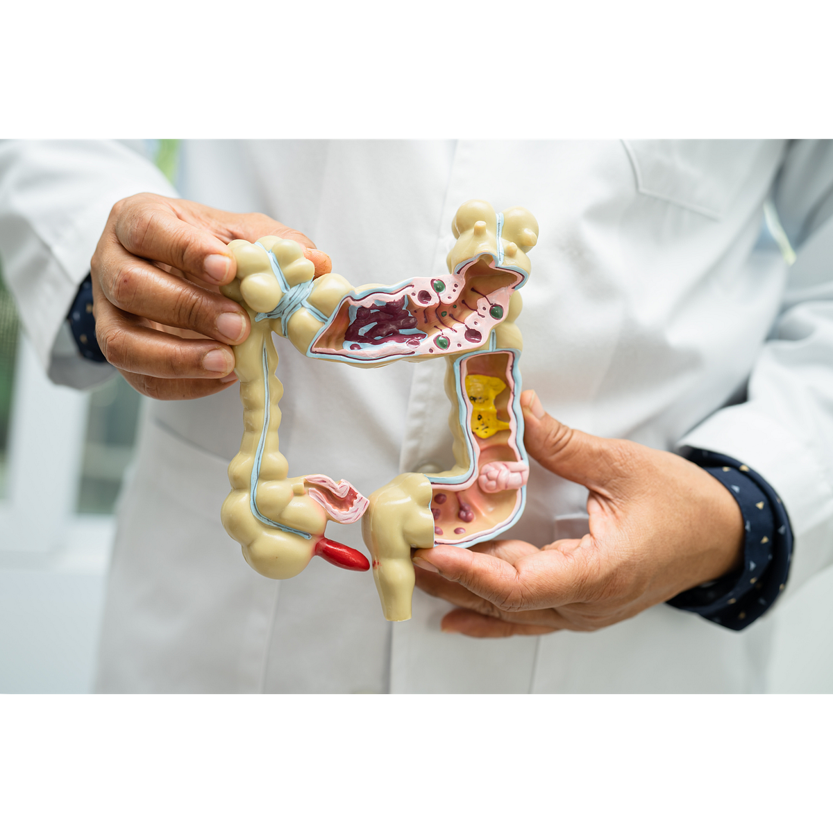 Why You Might Be Constipated Tired And Breaking Out — And Not Know Its Your Gut By Sana