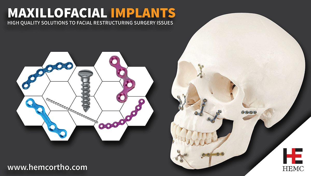 Maxillofacial implants India — high quality solutions to facial ...