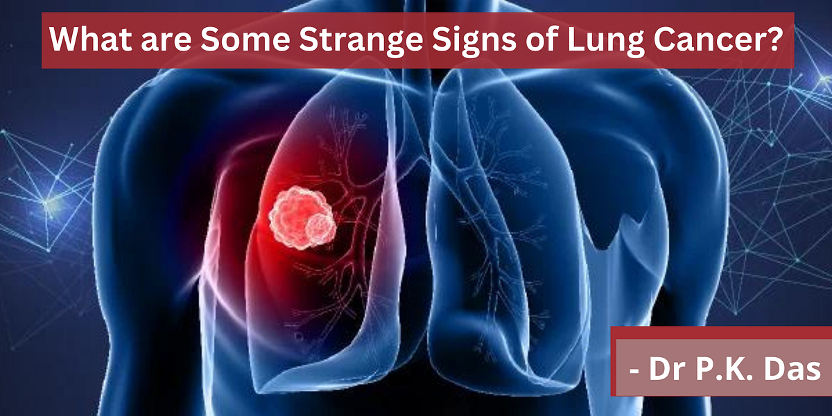 What are Some Strange Signs of Lung Cancer? | by Drpkdas | Medium