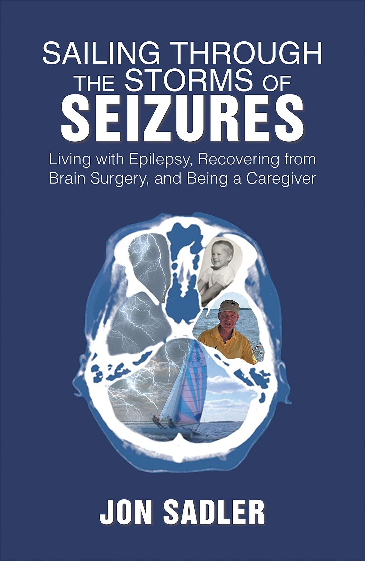 [READ]-Sailing Through the Storms of Seizures: Living with Epilepsy ...