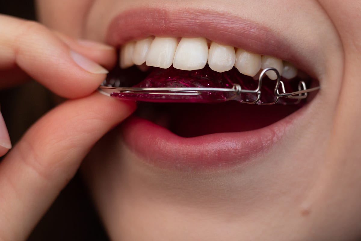 I’m The Retainer You’ve Neglected To Wear Since High School, And I Still Crave Your Touch | by ...
