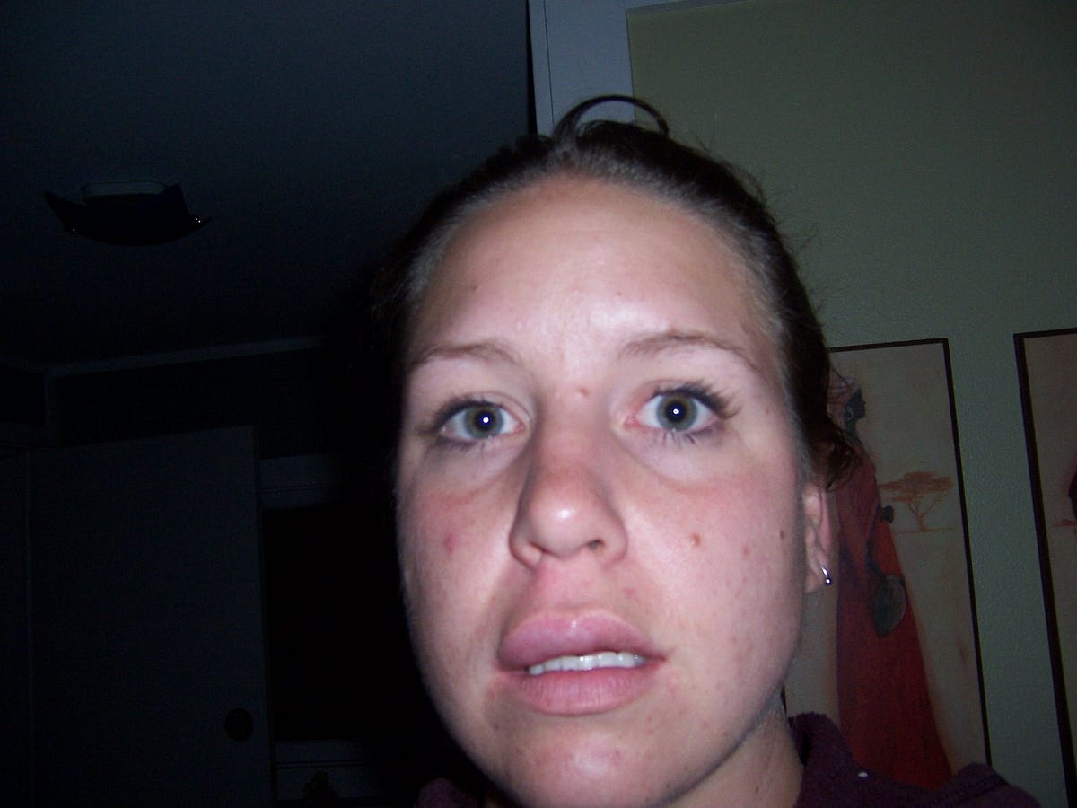 Bee the Cringe: When There’s No Choice But To Put Your Worst Face ...