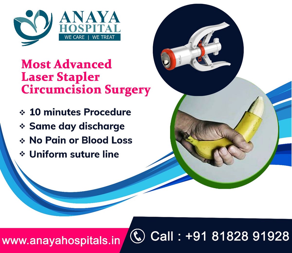 Advanced Laser & Stapler Laparoscopic Surgery - Anaya Hospitals - Medium