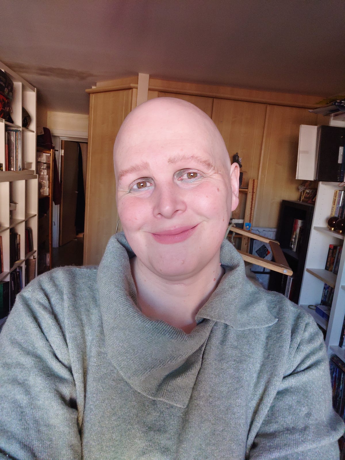 Living as a woman with alopecia. The greatest cosmic joke ever played ...