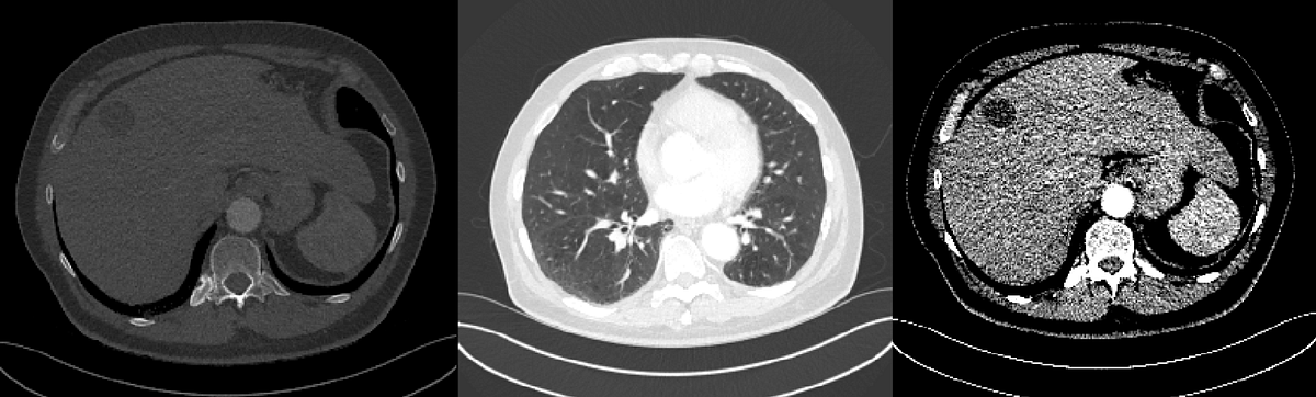 Decoding CT Scans: Simplifying Window Settings | by Mohammed El Amine ...