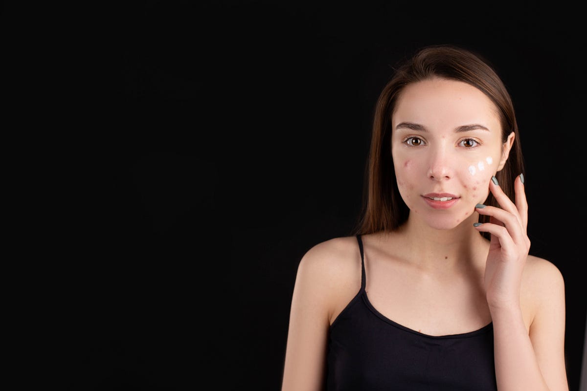 Understanding Comedones: Causes, Treatment, and Prevention Tips | by ...