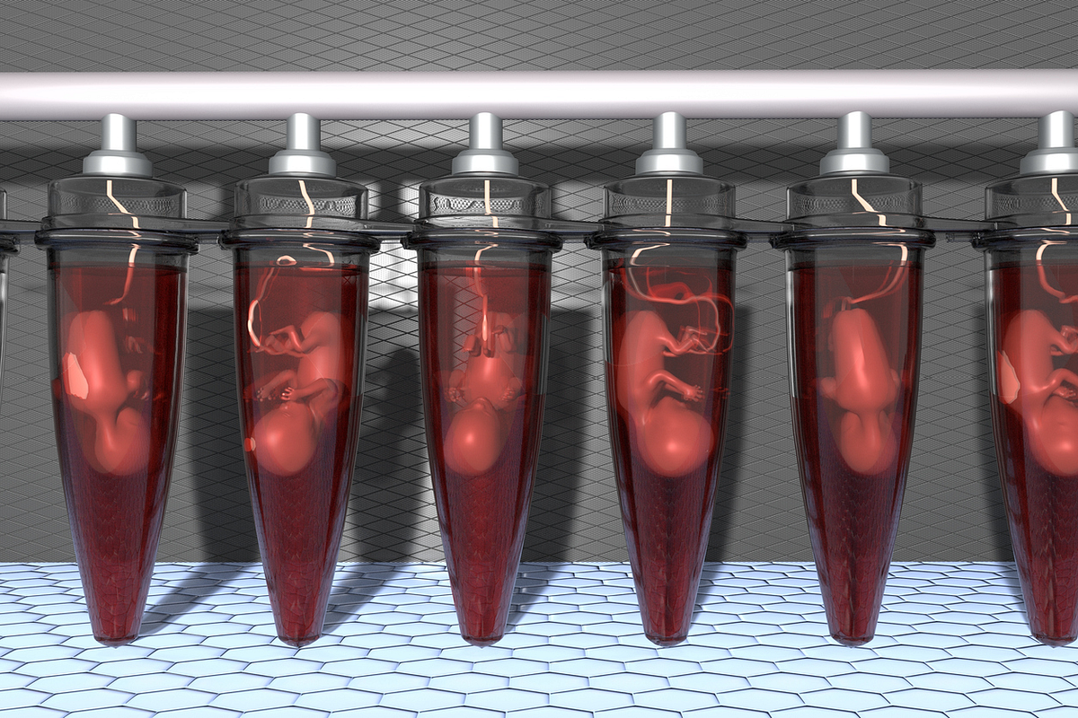Artificial Wombs: What’s Really Needed | by Matthew Eppinette | Medium
