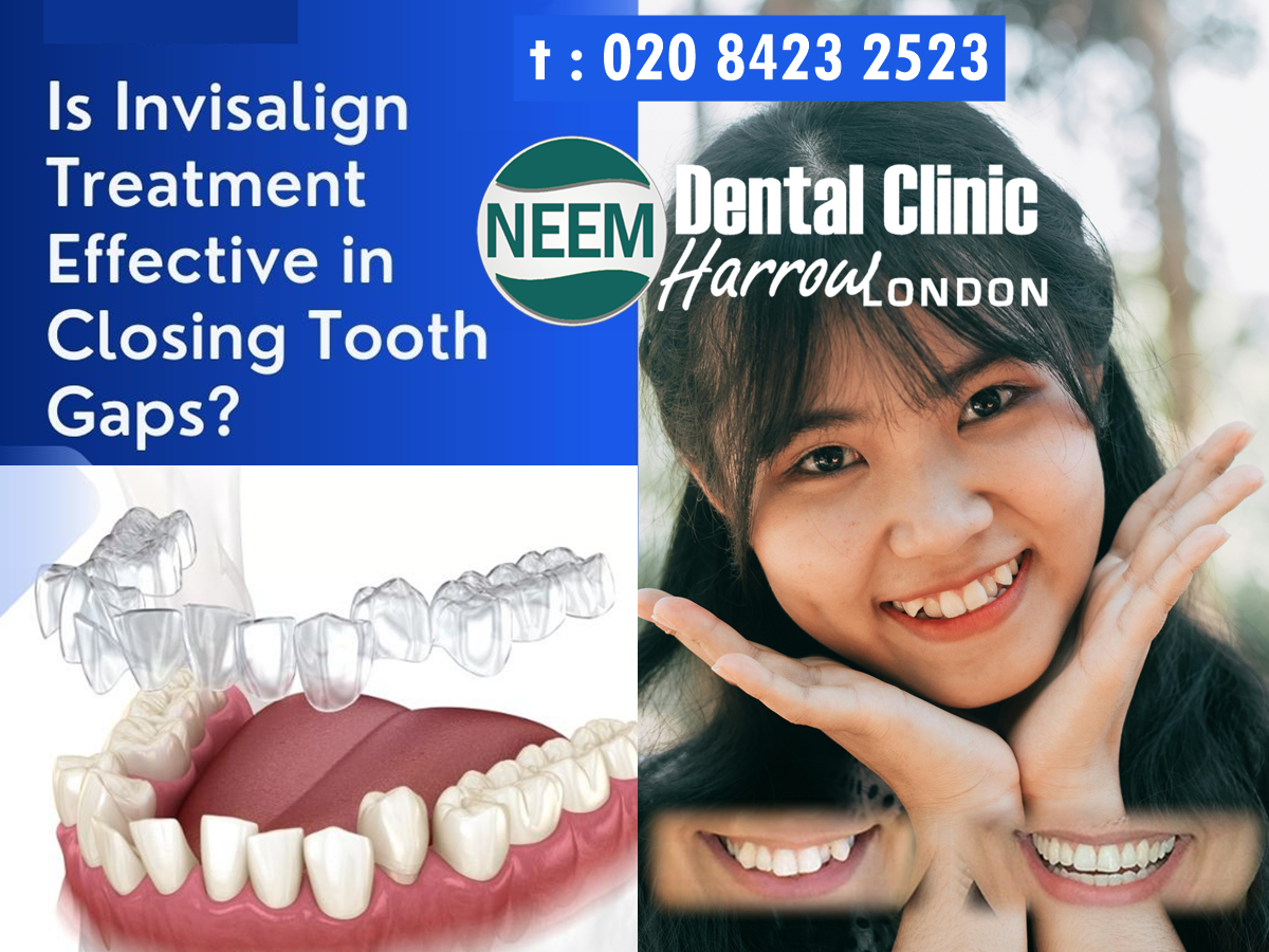 Can My Teeth Be Corrected With Invisalign? | by Emergency Dentist ...