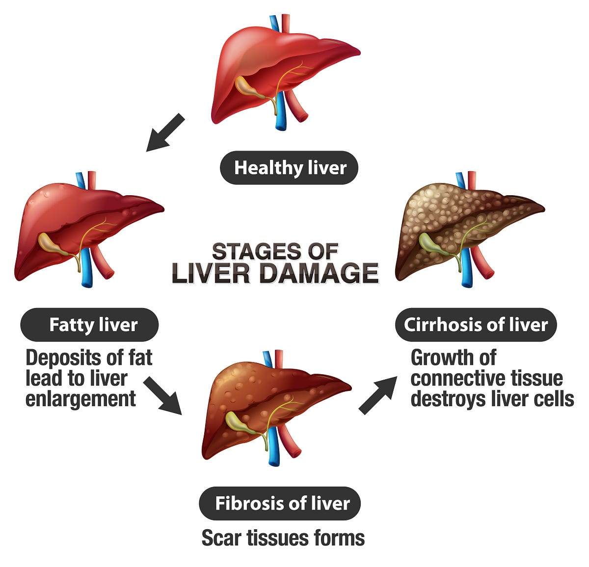 The Power of Liver Care: Your Key to Optimal Health | by Radhvi Rawat ...