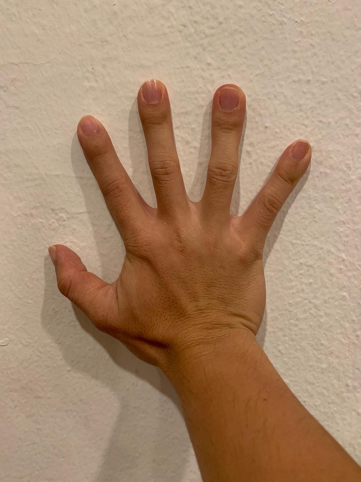 My Right Hand. Every so often, someone will exclaim… | by Ee Chien Chua ...