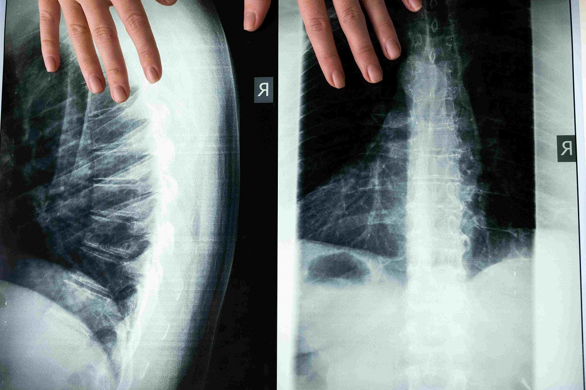 The Comprehensive Guide to Diagnostic Scans and Diagnostic X-Ray | by ...