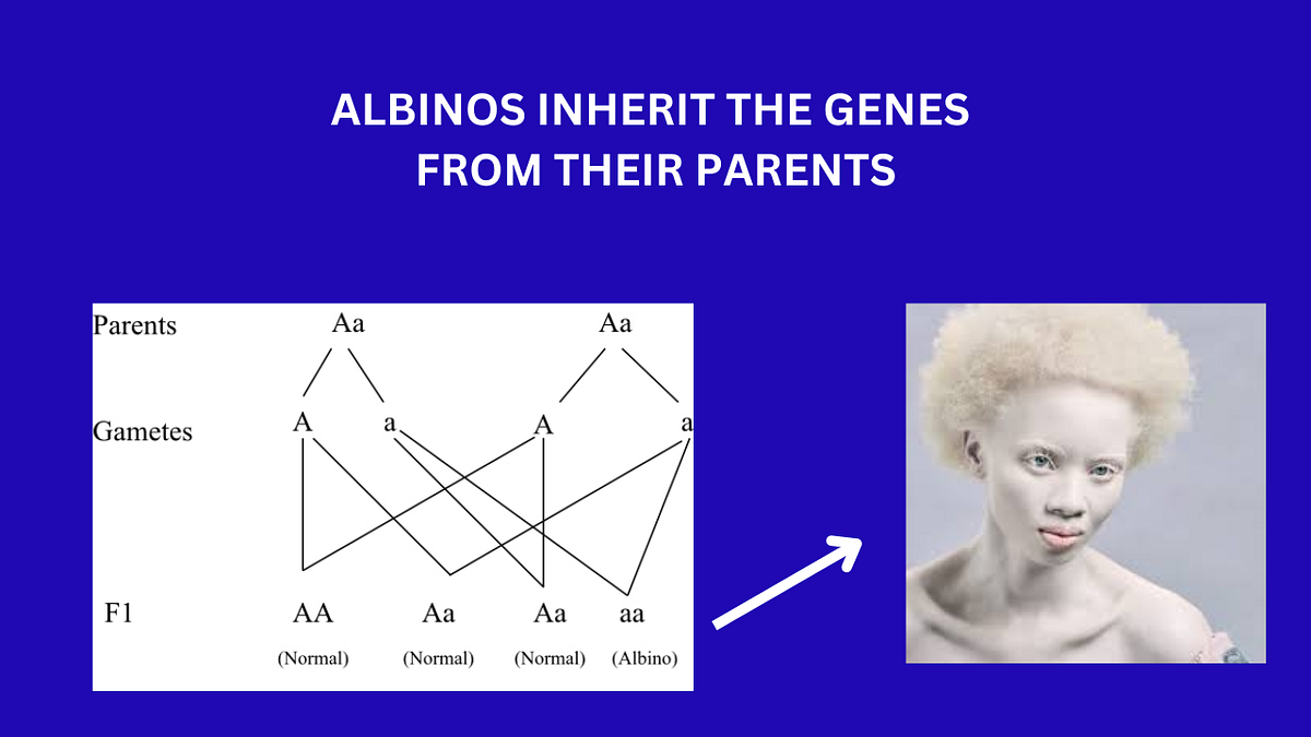 The Albino In You: Genetics of Albinism | by Mkpouto Pius | Dec, 2023 ...
