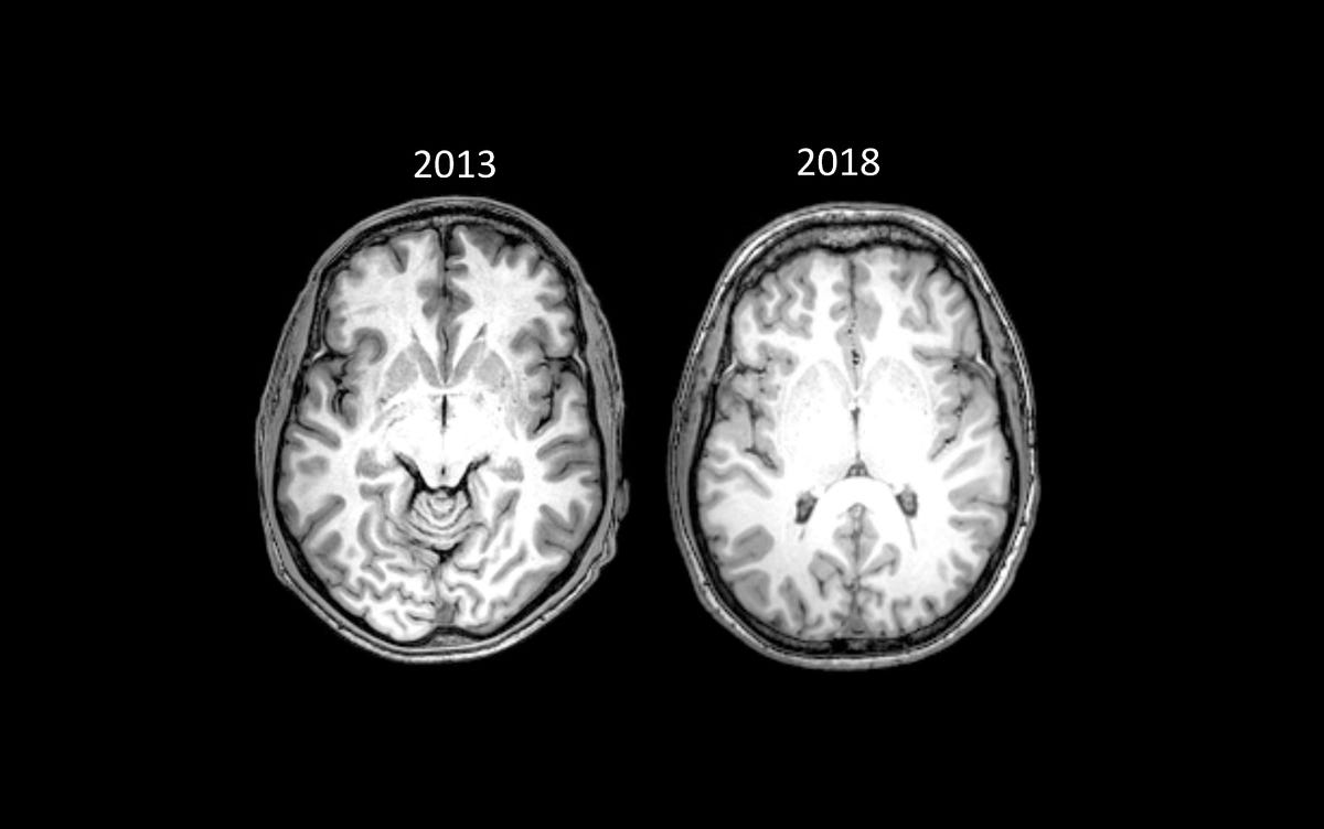 12 Age-Reversing Habits: How I Made My Brain 10 Years Younger | by ...