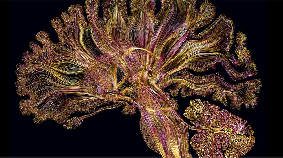 Brain-Computer Interfaces: Science, Tech, and Future | by Chandhana ...