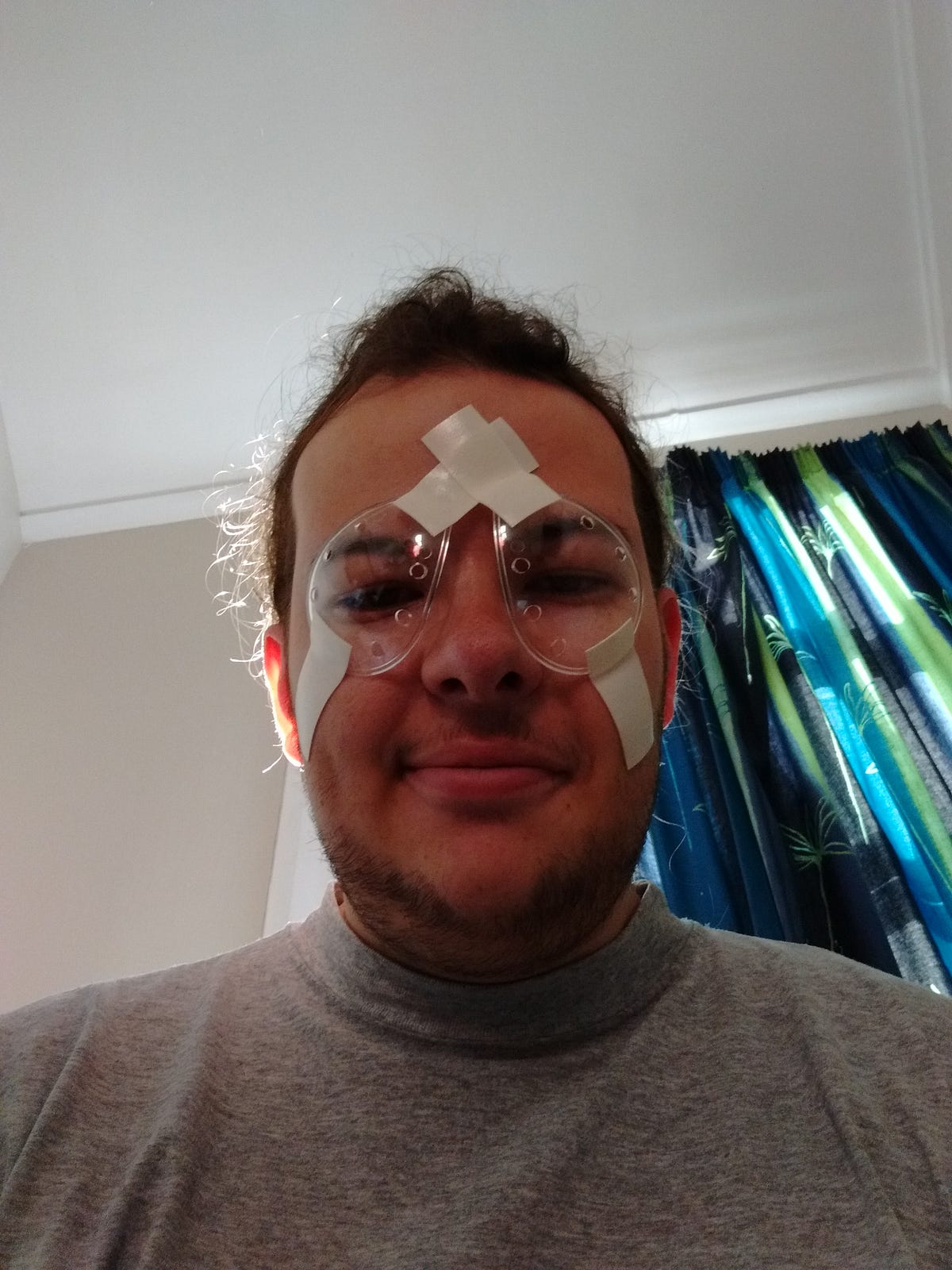 ICL: Eye surgery as seen by a patient | by Félix Saparelli | Medium