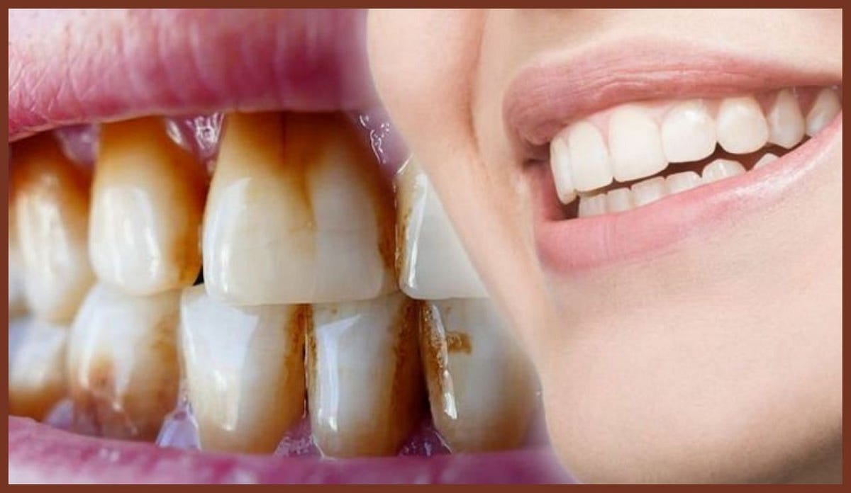 These superfood ingredients could restore perfect teeth and gums ...