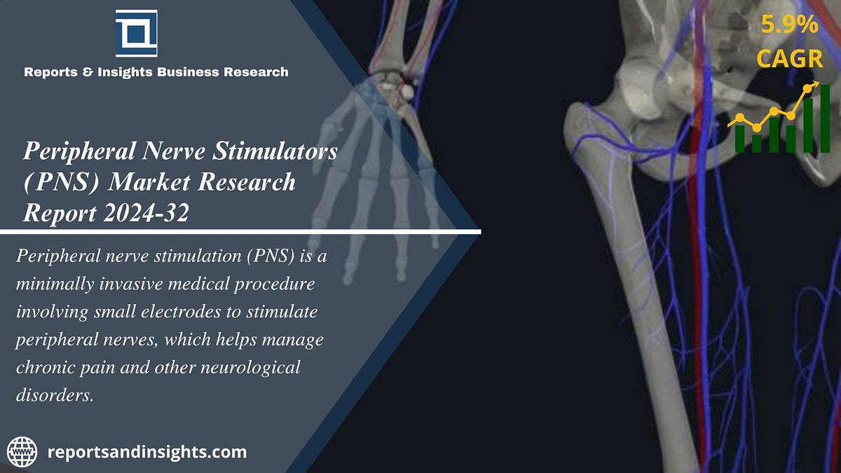 Peripheral Nerve Stimulators (PNS) Market Size, Industry Share ...