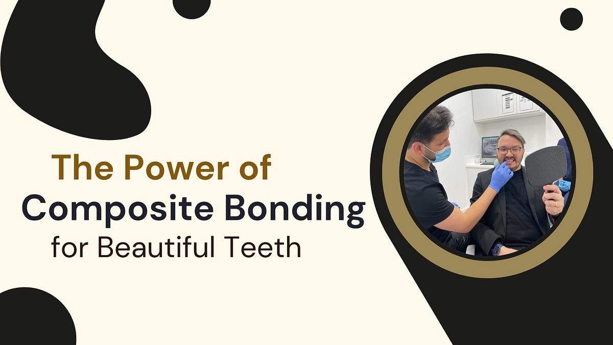 The Power of Composite Bonding for Beautiful Teeth - Thousand Smiles ...