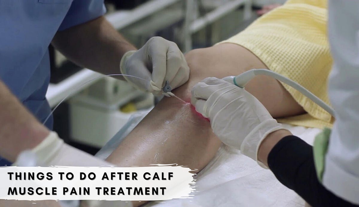Things to do after calf muscle pain treatment | by Endovascular Experts ...