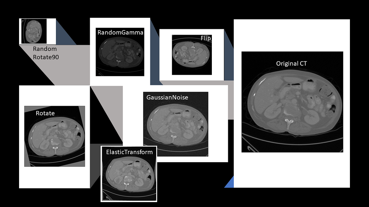 3D Data-Augmentation Using tf.data and Volumentations-3D Library | by ...