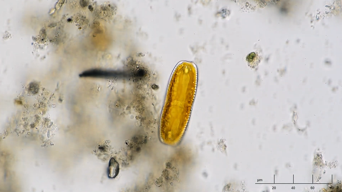 Guest Microscopy: Marine Plankton BioBlitz | Andy Chatman | Medium