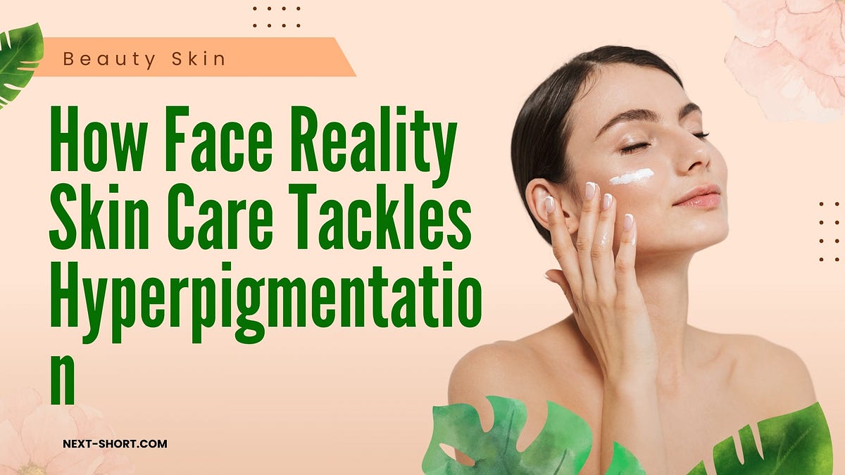 How Face Reality Skin Care Tackles Hyperpigmentation | by Samantha ...