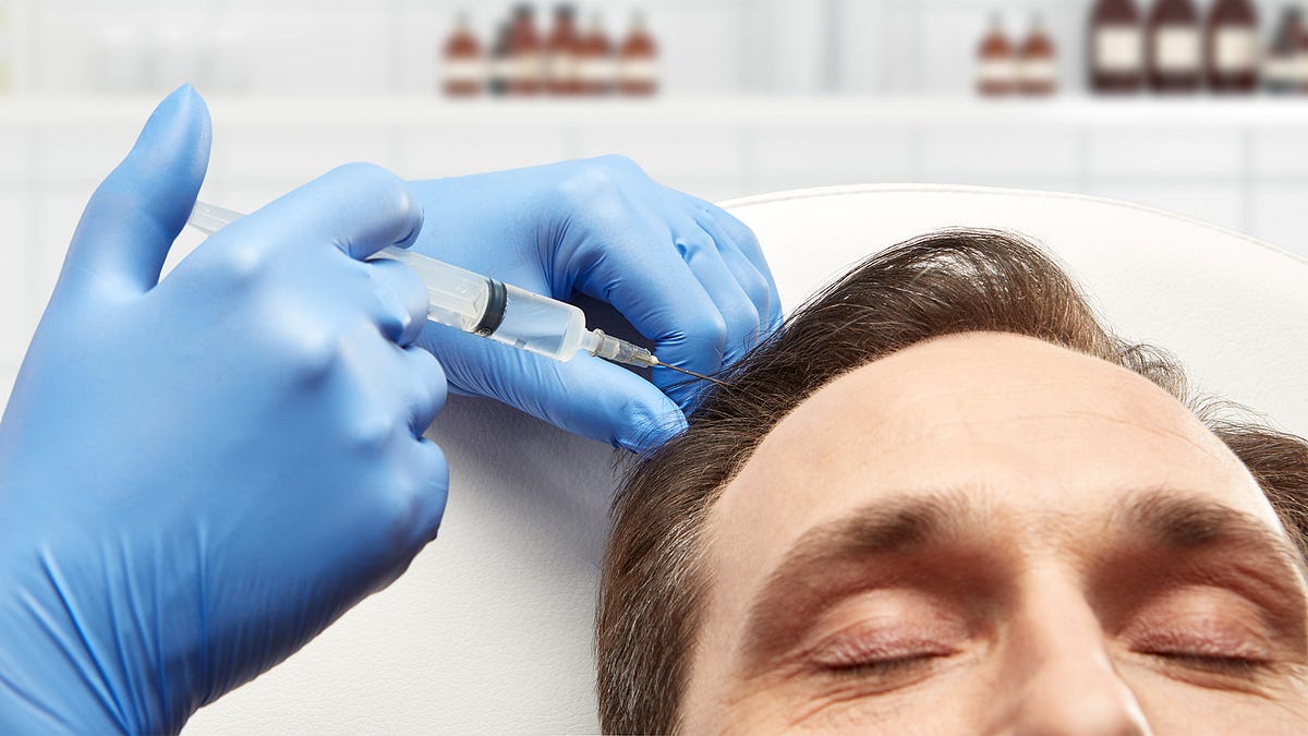 Advantages of PRP Treatment for Hair Loss | the Permanent Solution | by ...