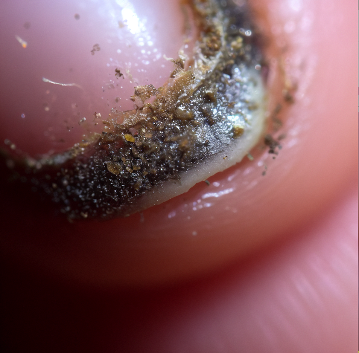 Top 5 Gross Things Under Your Dirty Fingernails | by Hollywood AI With ...