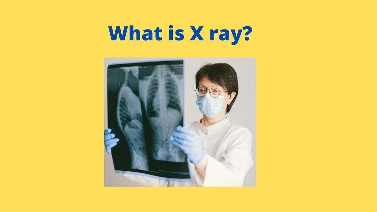 X Ray Definition Properties History And Applications