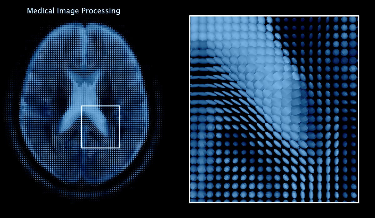Medical Image Analysis with Deep Learning — I | by Taposh Dutta-Roy ...