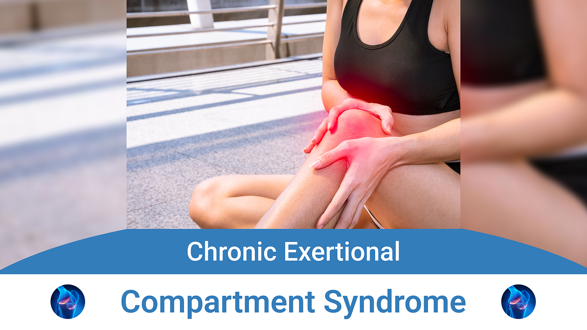 Chronic Exertional Compartment Syndrome - Advanced Clinical Physiotherapy - Medium