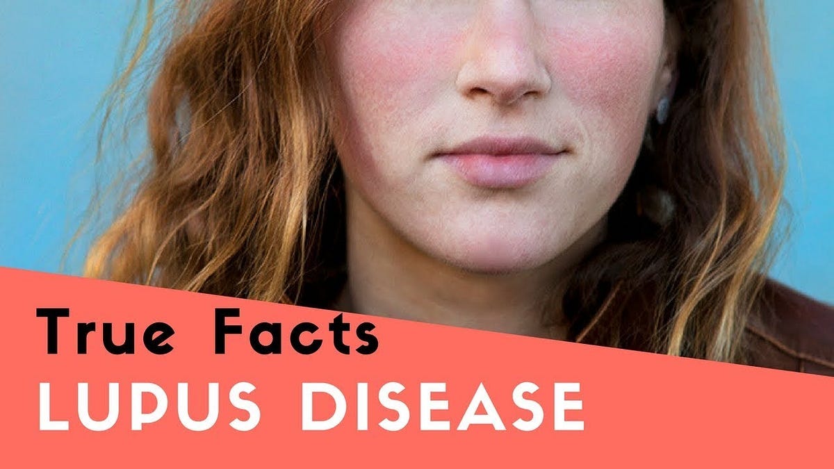 Advancements in Lupus Diagnostics: Emerging Business Perspectives | by Aayanshah | Aug, 2023 ...