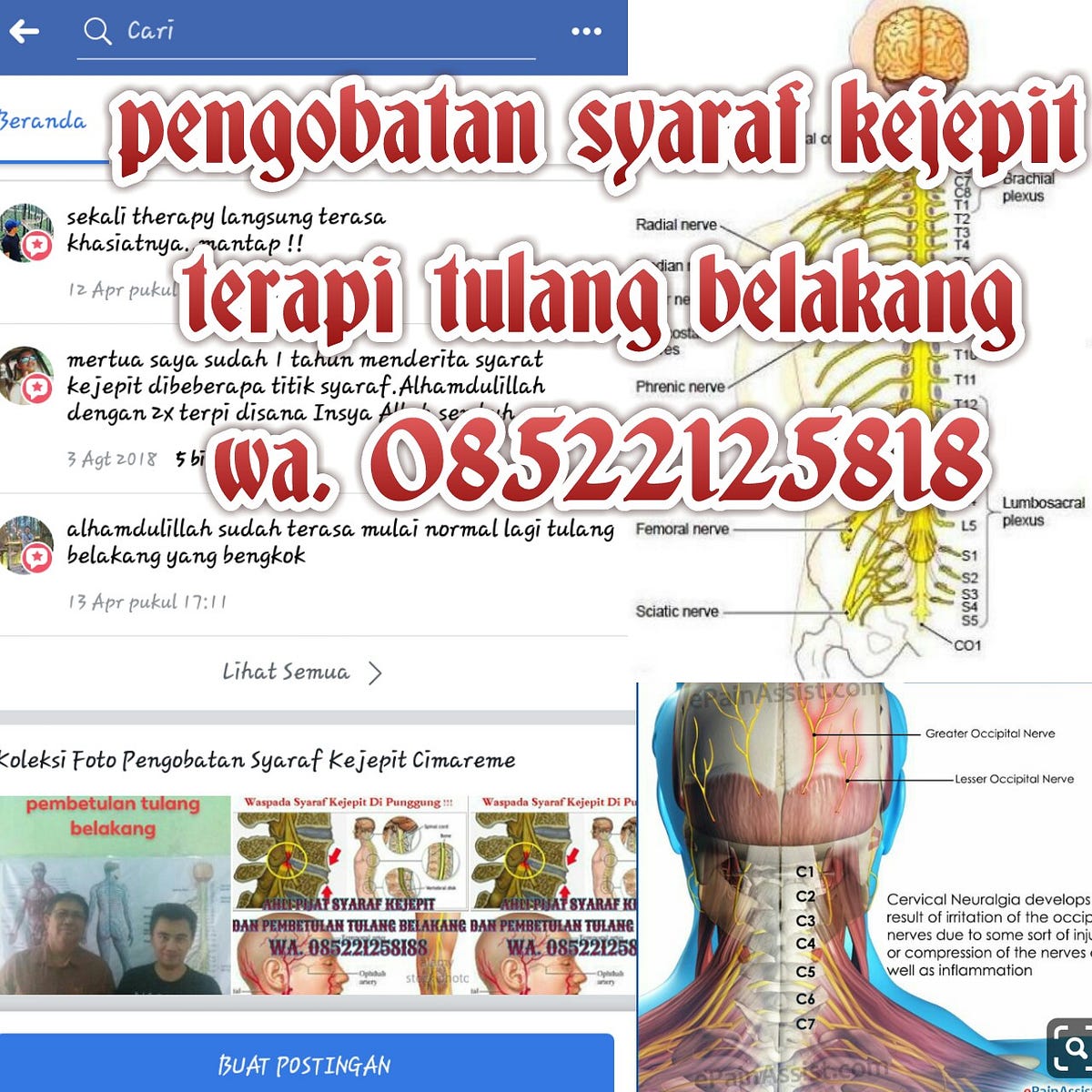 #ahli pijat saluran urat syaraf Bandung #Pengobatan Syaraf Kejepit DiBandung #Pengobatan Syaraf ...