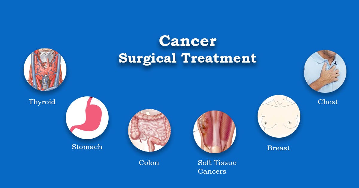 Types of Cancer Surgeries Performed by Surgical Oncologist | by Dr ...