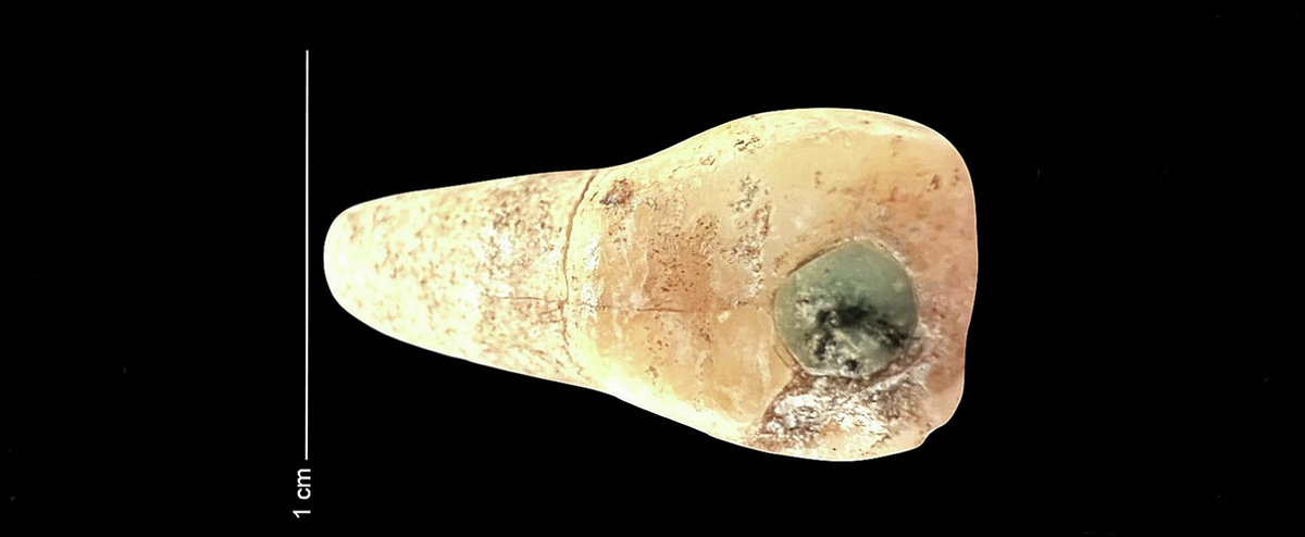 Your Teeth Are Green: When Maya Children Wore Jade in Their Teeth | by ...