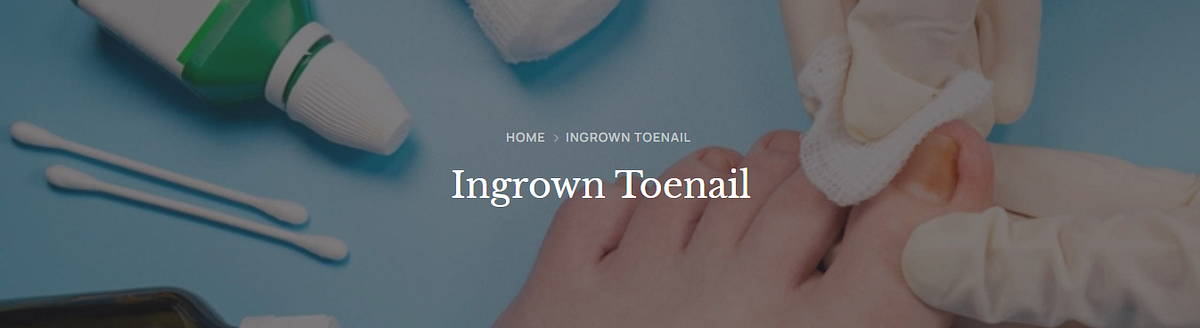 Effective Ingrown Toenail Treatment and Removal by North London Foot ...