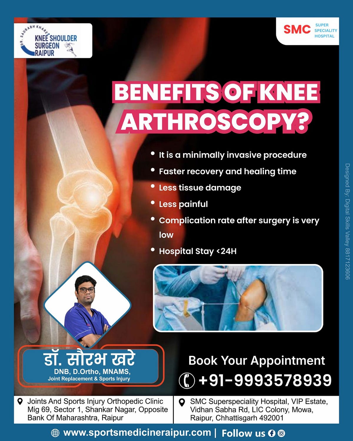 The Benefits of Knee Arthroscopy: A Minimally Invasive Solution for ...