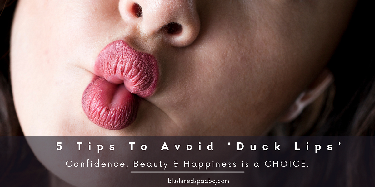 5 Tips To Avoid ‘Duck Lips’. Lip filler with Hyaluronic Acid is… | by ...