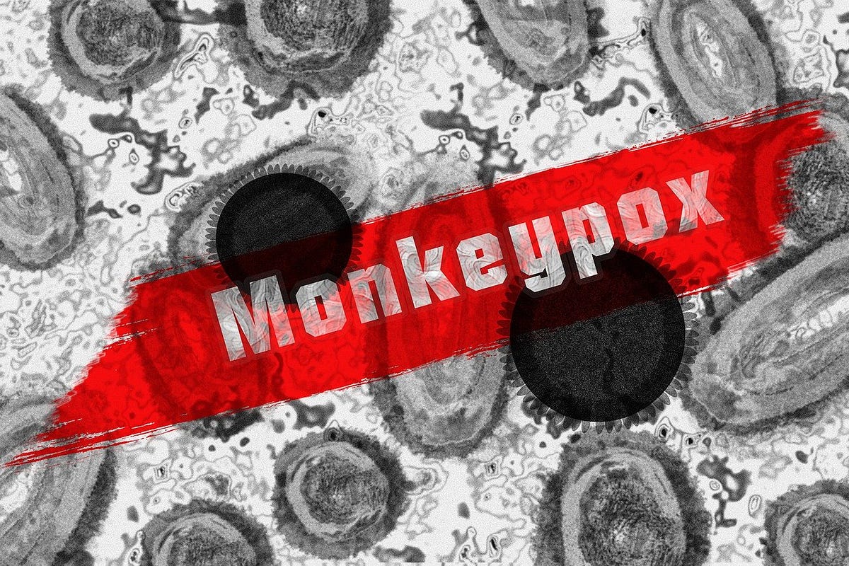 Monkeypox: What Do We Know and What Can We Do about This Imminent ...