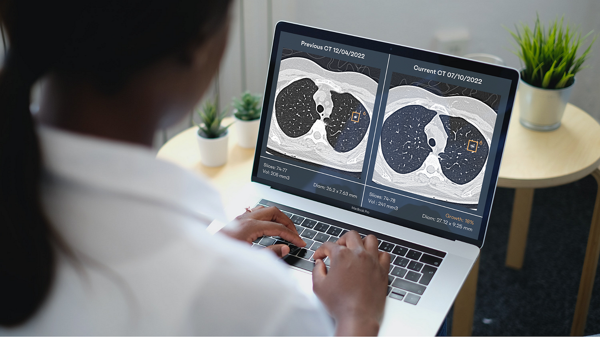 Revolutionizing Oncology with AI | Medium